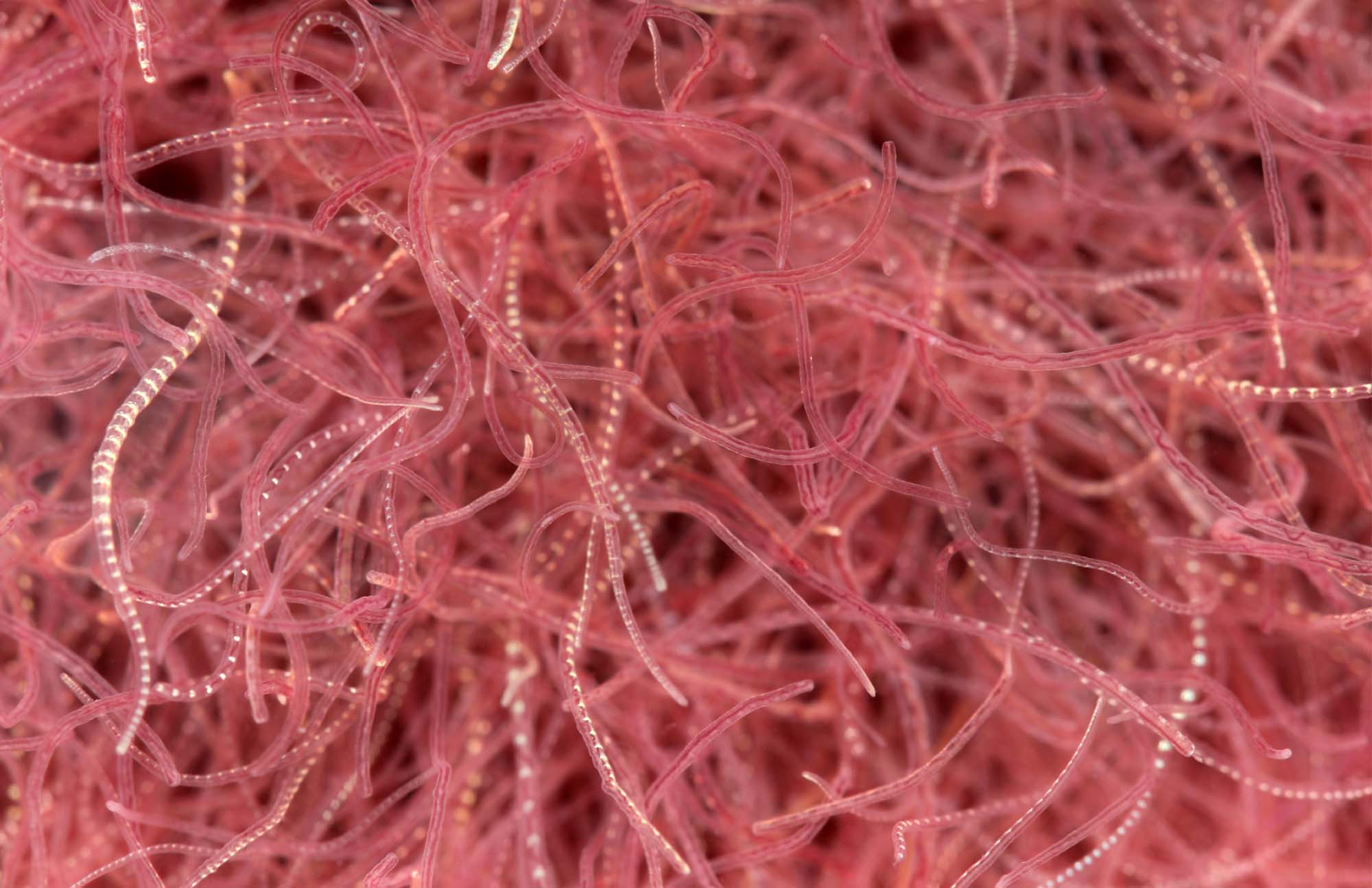 Red Worms In Fish Tank (best 8 Types Of Worms Information)